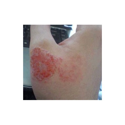 L'Europe demande le retrait du Parfenac - AgoraVox le média citoyen